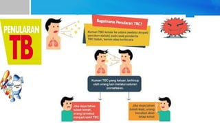 TUBERCULOSIS DISEASE.pptx