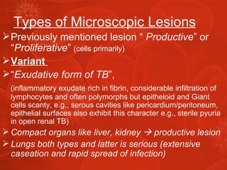 Tuberculosis (extra pulmonary) | PPT