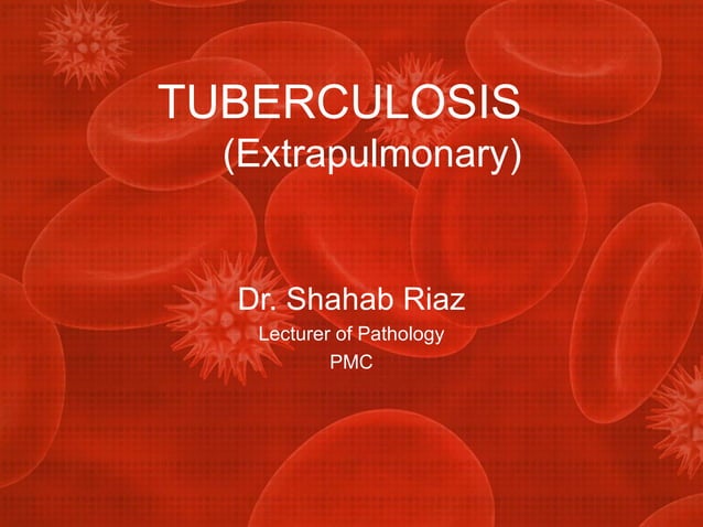 Tuberculosis (extra pulmonary) | PPT | Lung and Respiratory Health ...