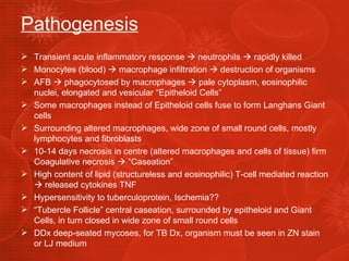 Tuberculosis (extra pulmonary) | PPT