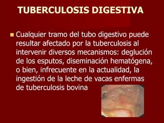 Tuberculosis extrapulmonar radiopatologia | PPTX