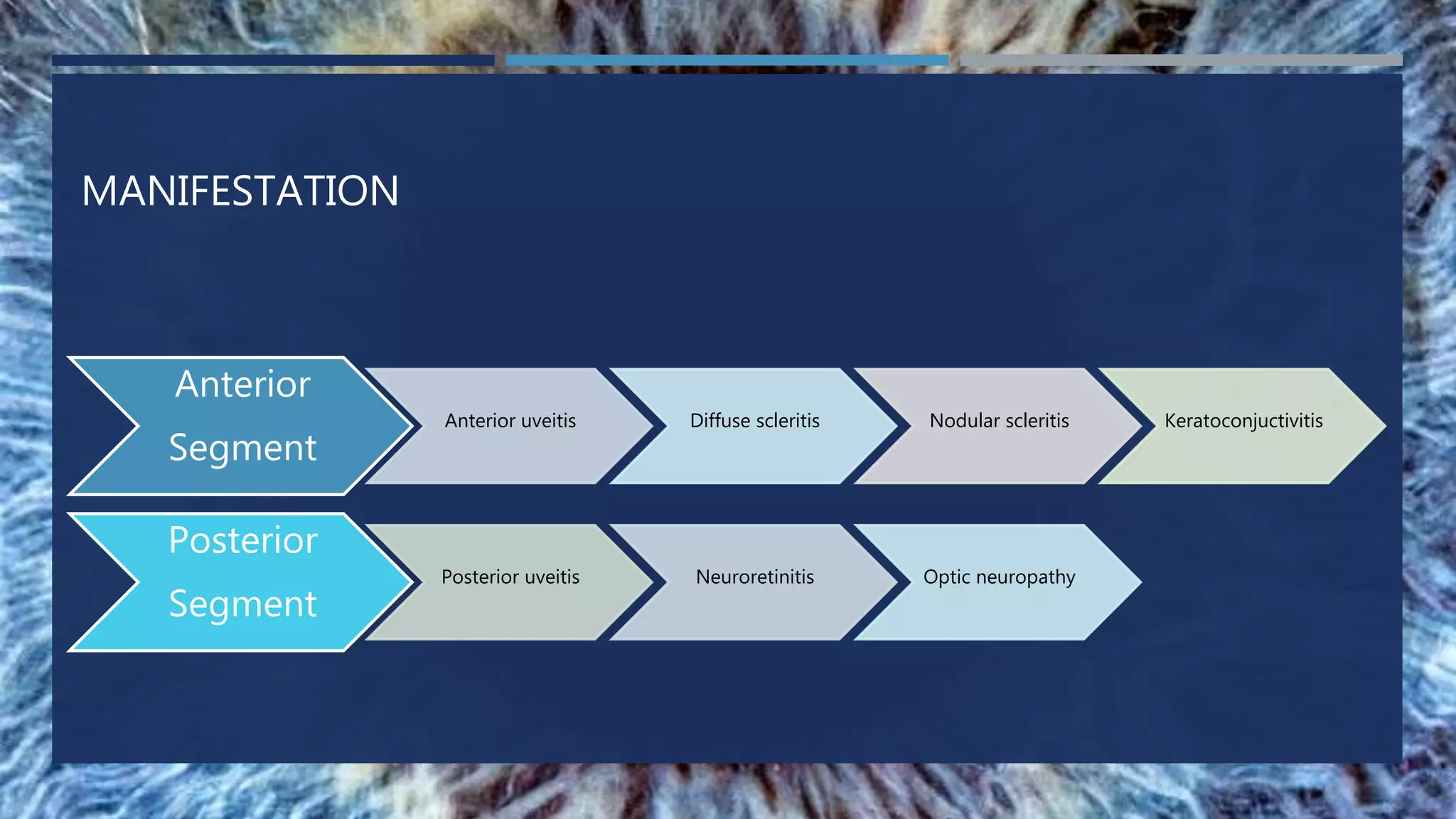 Ocular Manifestations of Tuberculosis | PPTX