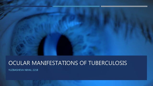 Ocular Manifestations of Tuberculosis | PPTX