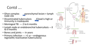 tuberculosis introduction and pathophysiology | PPT