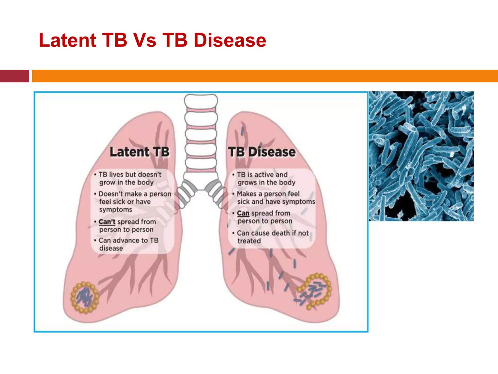 Tuberculosis | PPTX