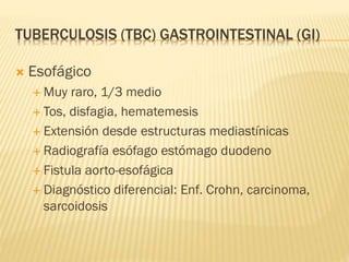 Tuberculosis gastrointestinal | PPTX