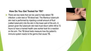 TUBERCULOSIS.pptx