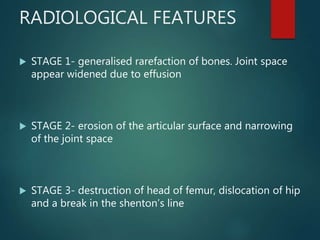 Tuberculosis of Hip Joint | PPT