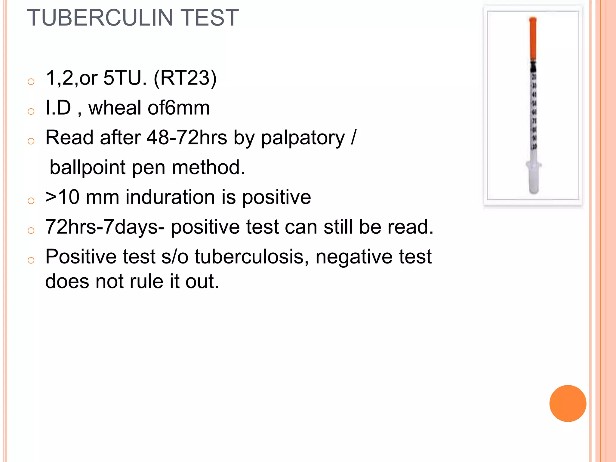 Tuberculosis in children | PPTX