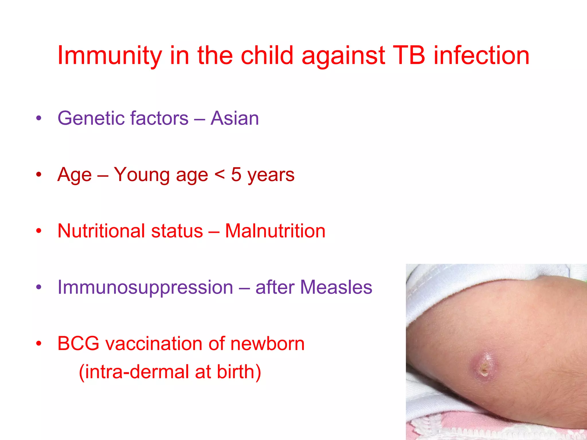 Tuberculosis in children 2021 | PDF