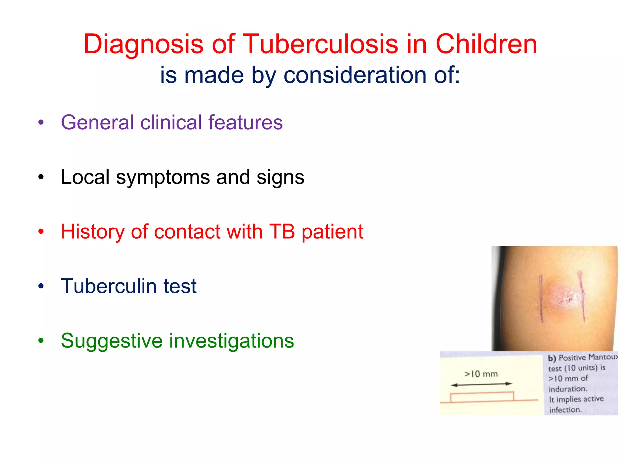 Tuberculosis in children 2021 | PDF