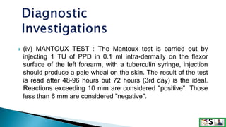 Tuberculosis in english tb | PPT