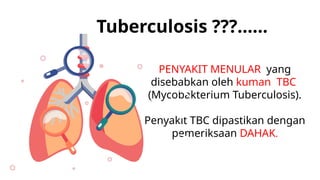 Tuberculosis Infographics by Slidesgo.pptx