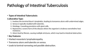 tuberculosis in surgery for under graduates .pptx