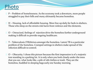 Tuberculosis in the homeless | PPTX