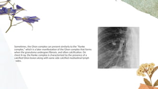 Tuberculosis kogi copy.pptxgfhnfgbftyrtghbcxt | PPTX | Lung and ...