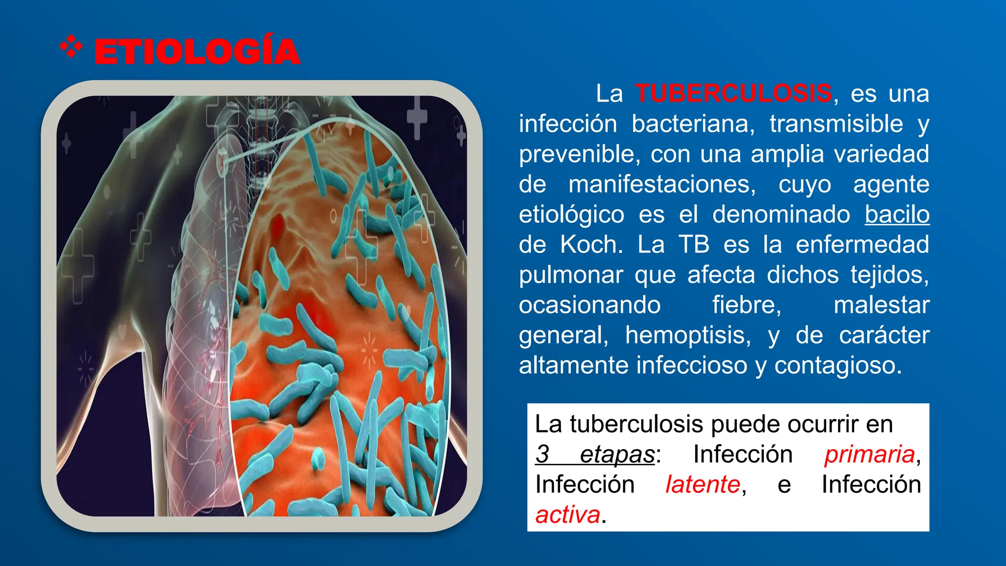 Tuberculosis TBC MEDICINA GENERAL - unerg | PPTX