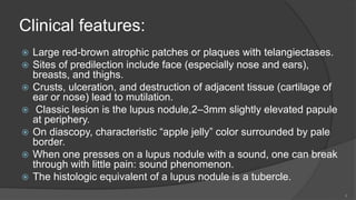 Tuberculosis, leprosy.pptx