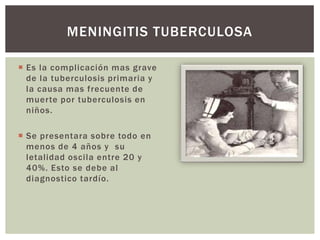Tuberculosis meningea | PPTX