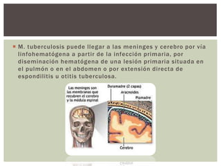 Tuberculosis meningea | PPTX