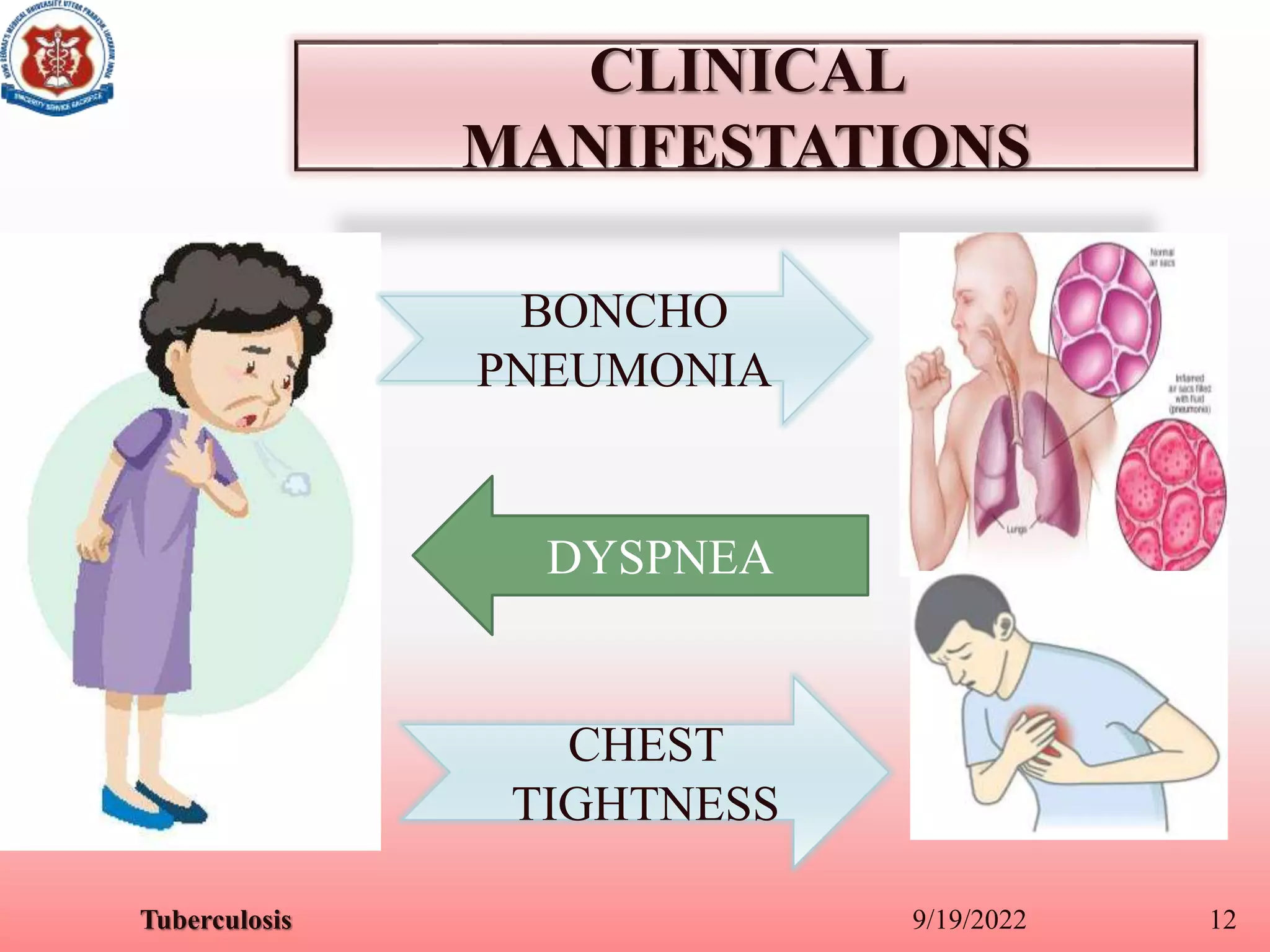 tuberculosis (MSN).pptx