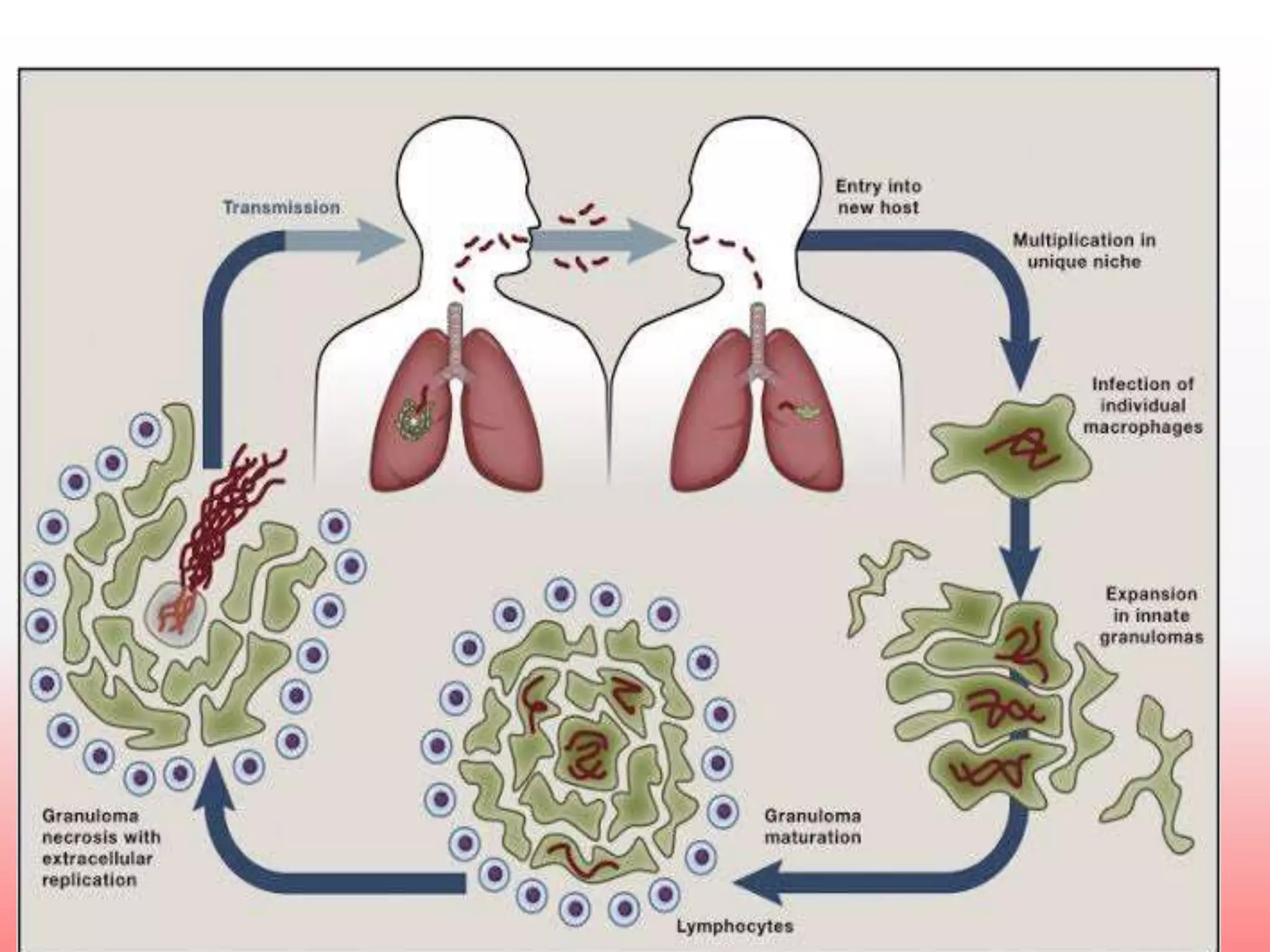 tuberculosis (MSN).pptx