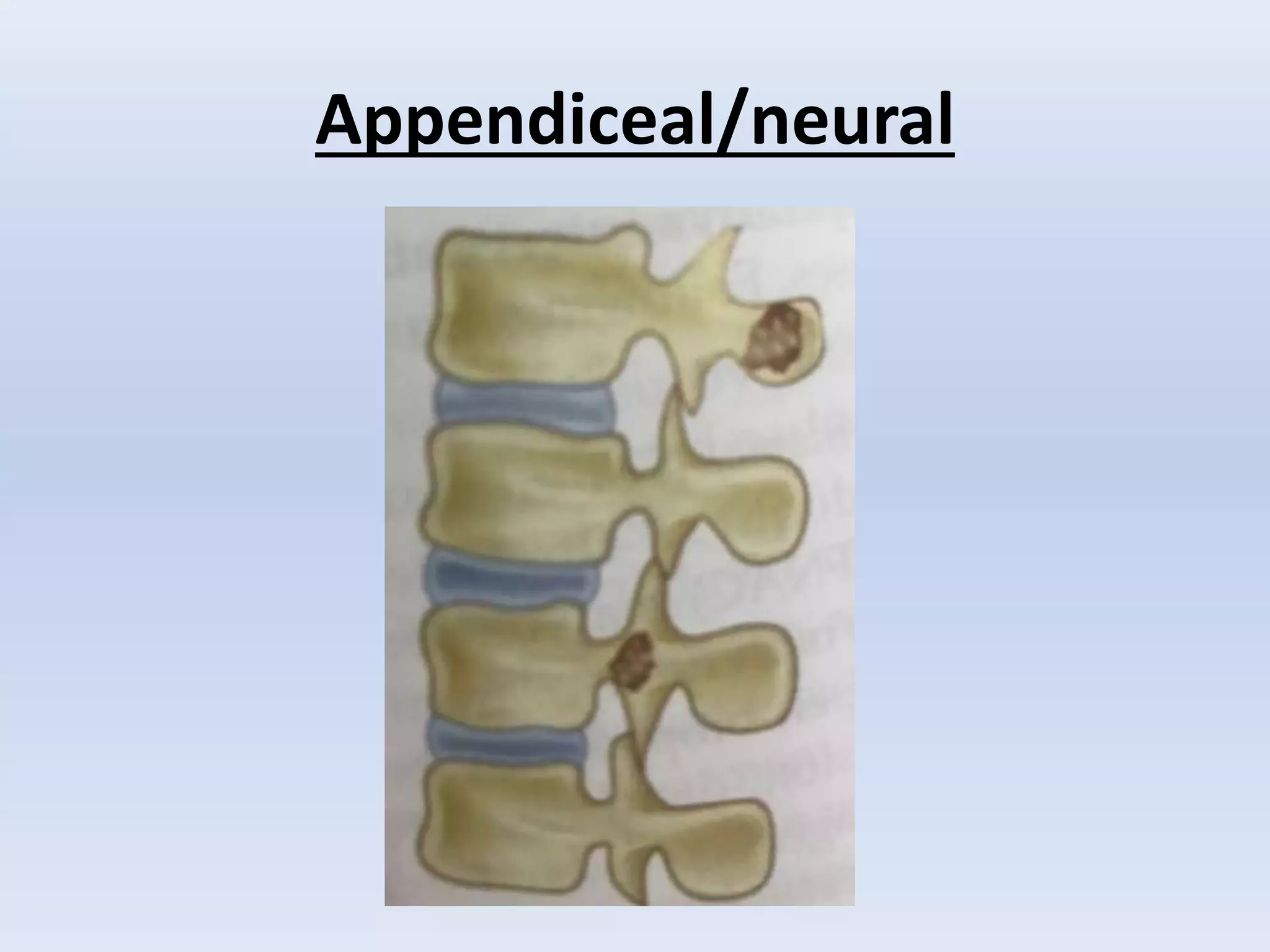 Tuberculosis Of Bone And Joints Ppt