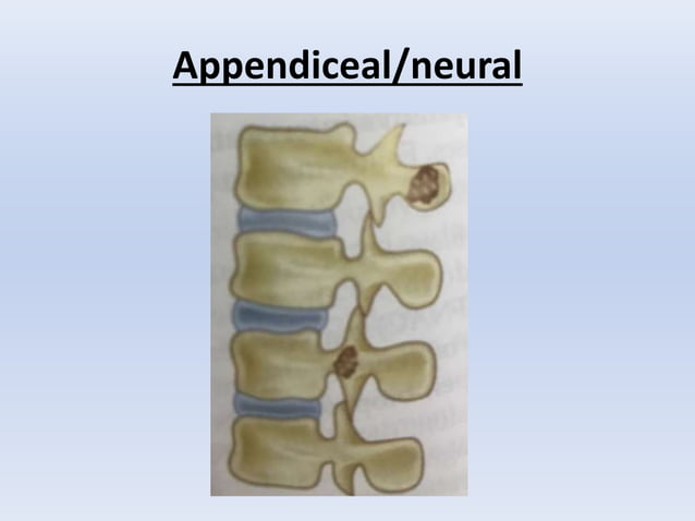 Tuberculosis of bone and joints | PPTX