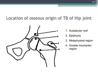 Tuberculosis of hip and knee | PPT