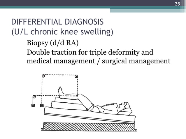 Tuberculosis of hip and knee | PPT