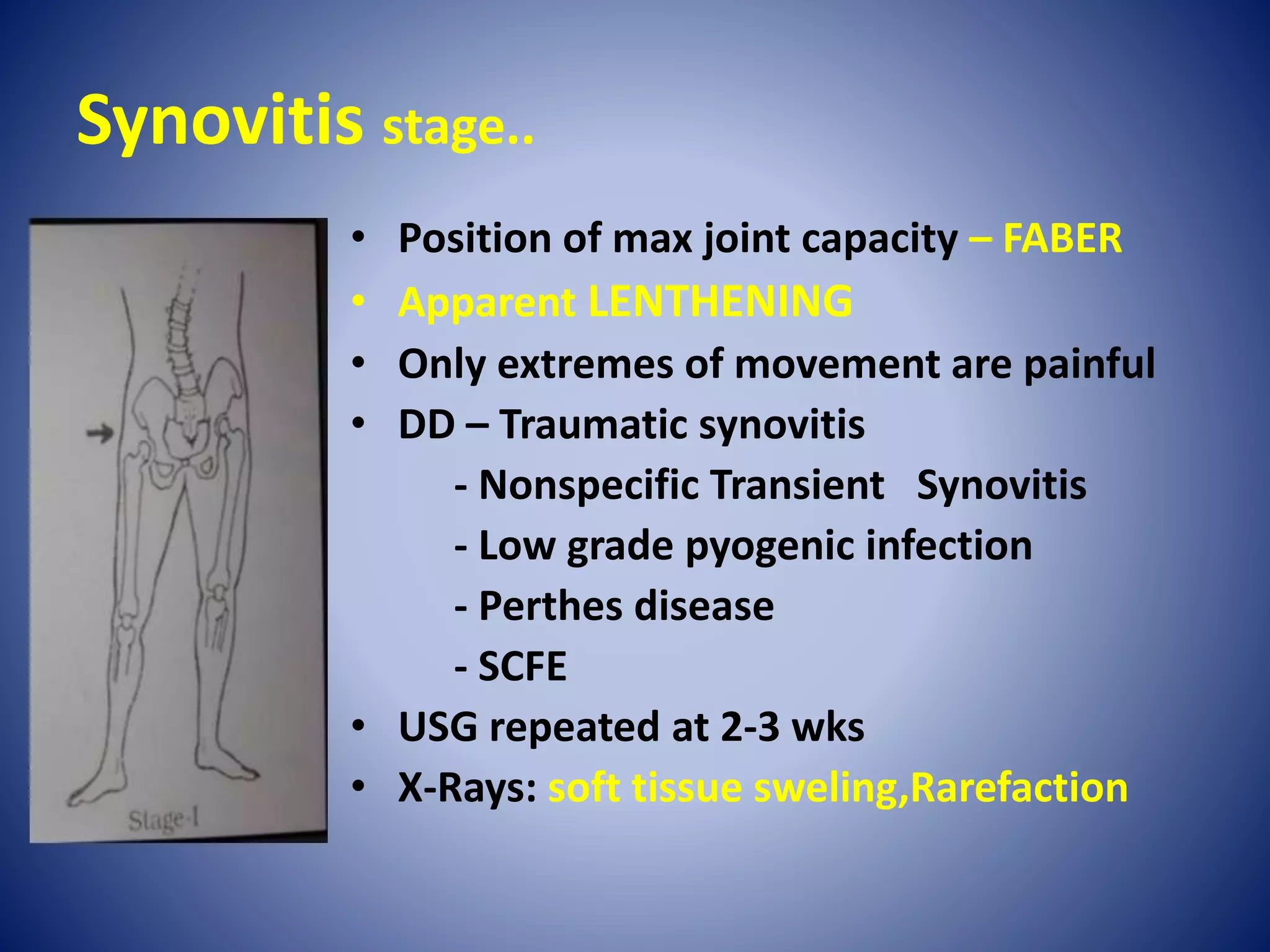 Tuberculosis of hip joint | PPTX
