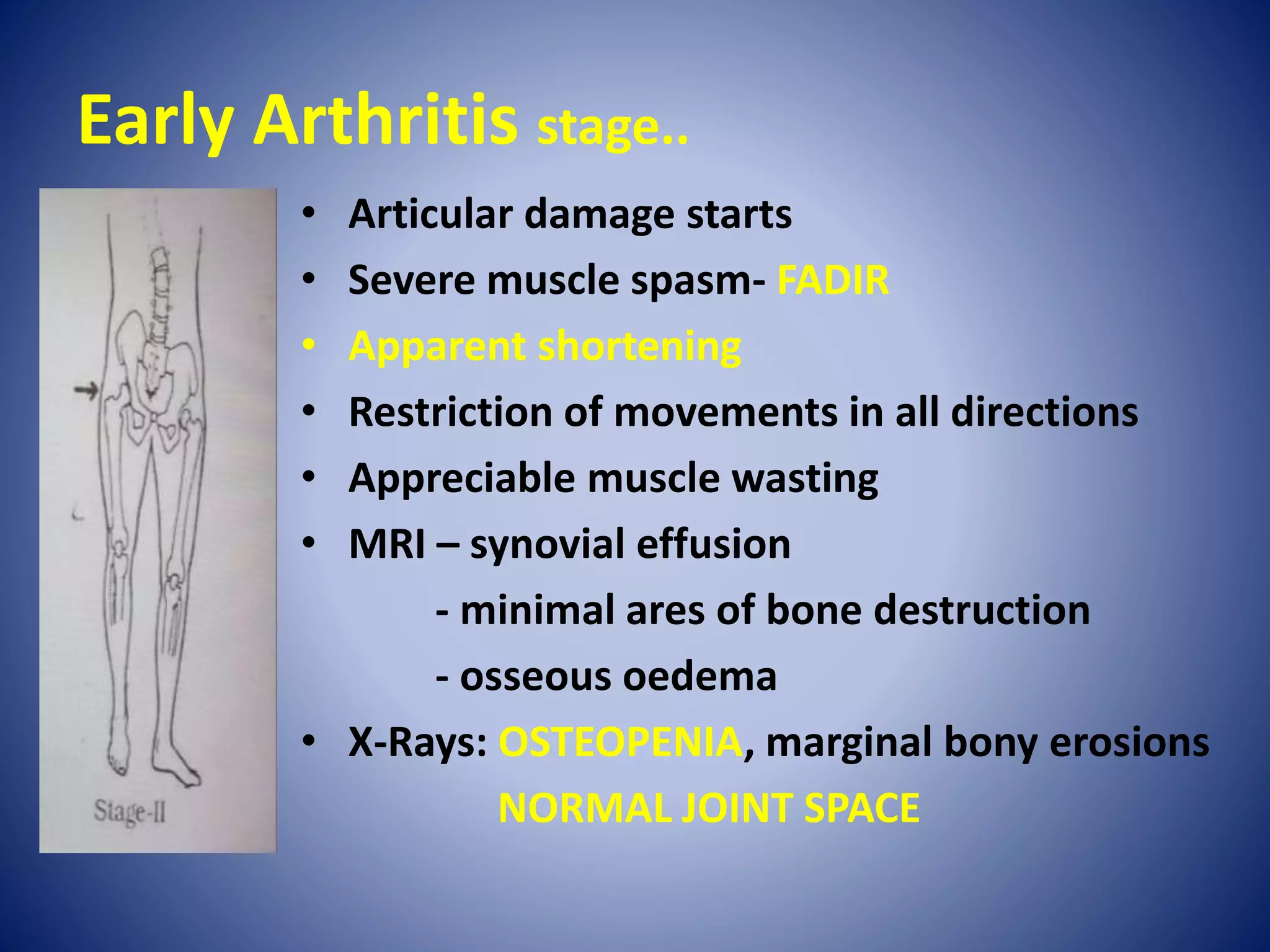 Tuberculosis of hip joint | PPTX