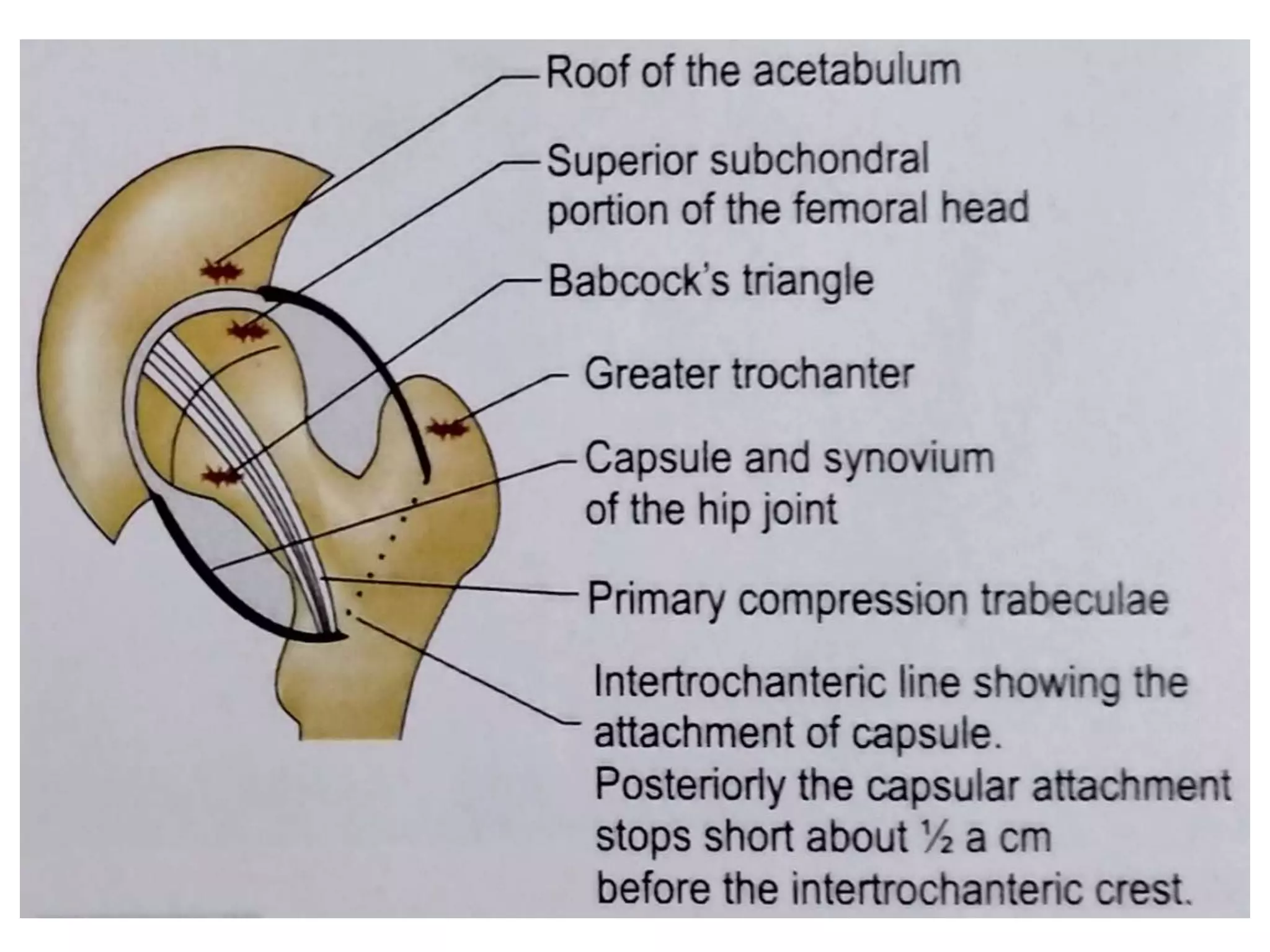Tuberculosis of Hip joint and Management-30-06-2021.pptx