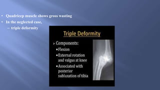 Tuberculosis of knee by dr ashutosh | PPTX