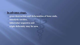 Tuberculosis of knee by dr ashutosh | PPTX