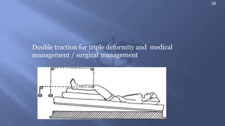 Tuberculosis of knee by dr ashutosh | PPTX