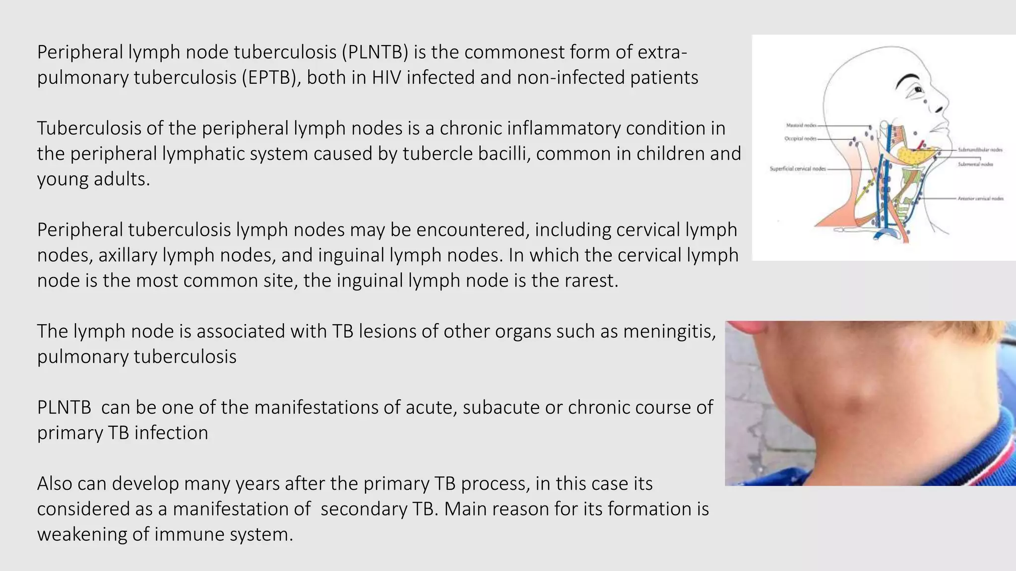 Tuberculosis of peripheral lymph nodes.pptx | Ear, Nose and Throat ...