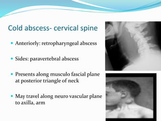 TUBERCULOSIS OF SPINE.pptx