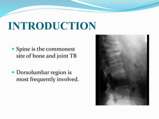 TUBERCULOSIS OF SPINE.pptx