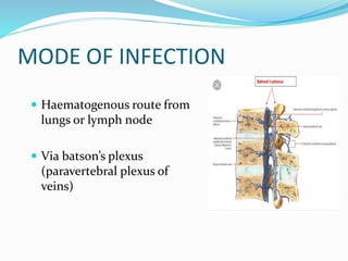 TUBERCULOSIS OF SPINE.pptx