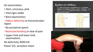 Tuberculosis of spine mad | PPTX
