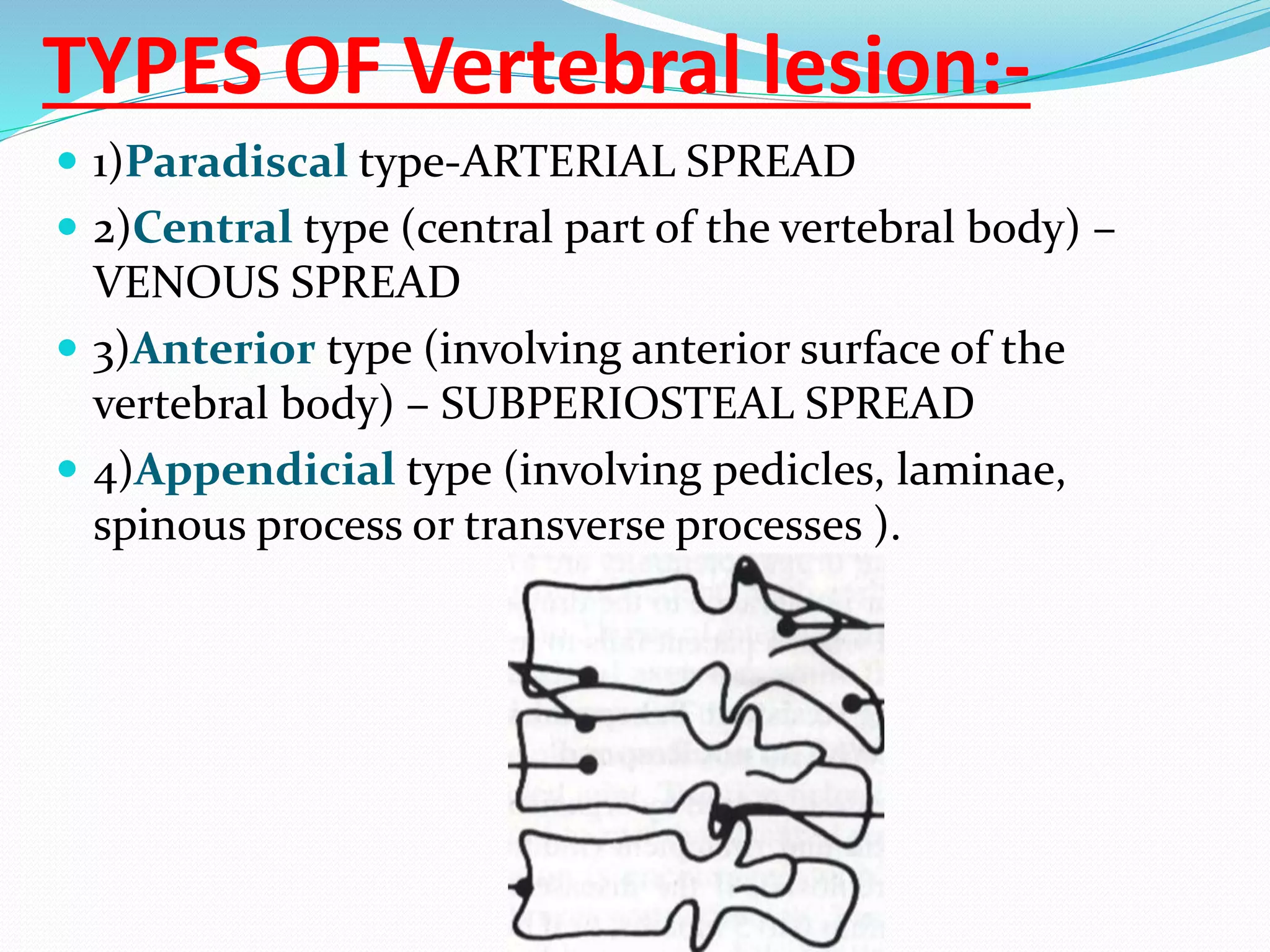 Tuberculosis of spine (pott’s spine) | PPTX