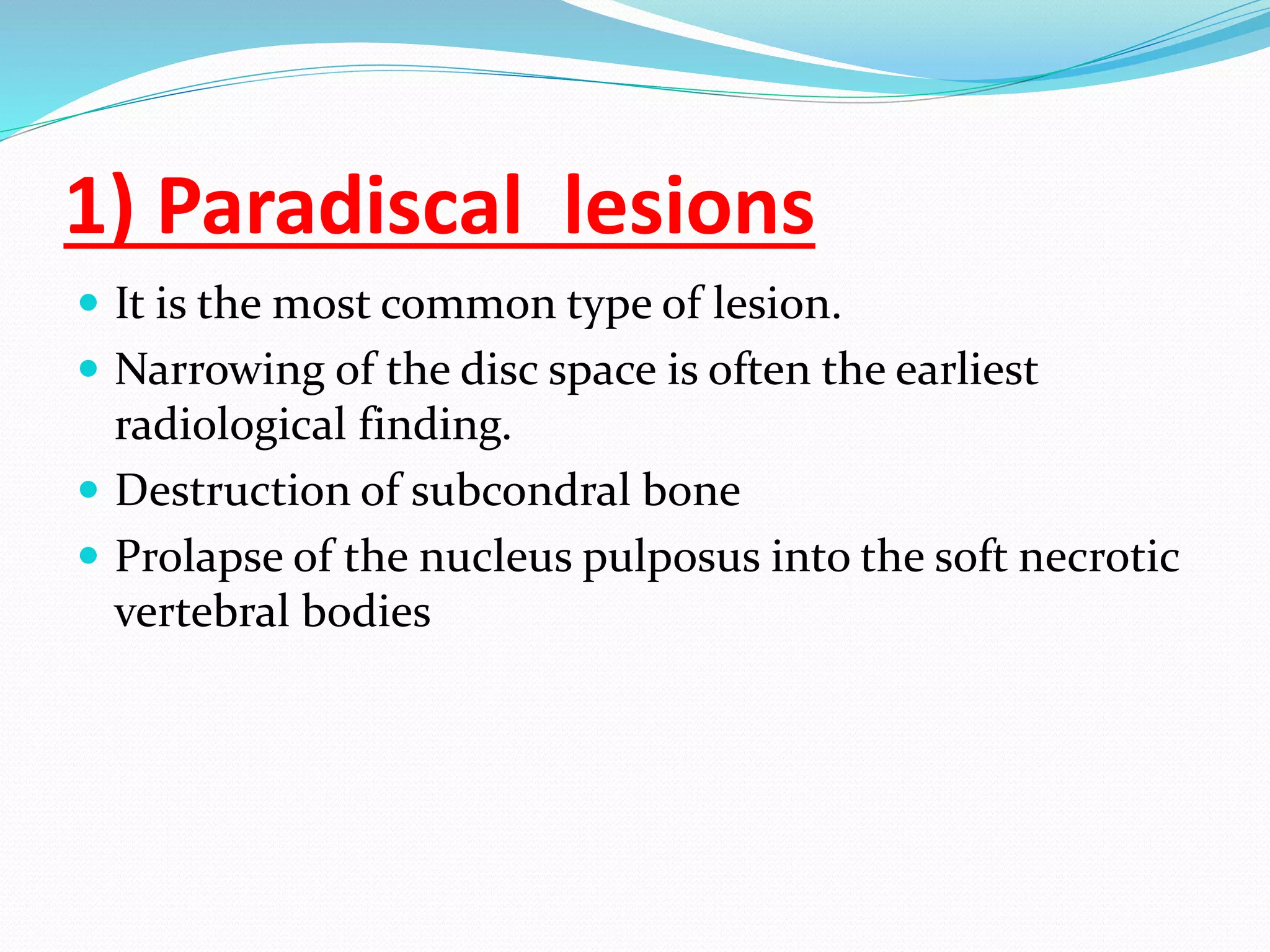 Tuberculosis of spine (pott’s spine) | PPTX