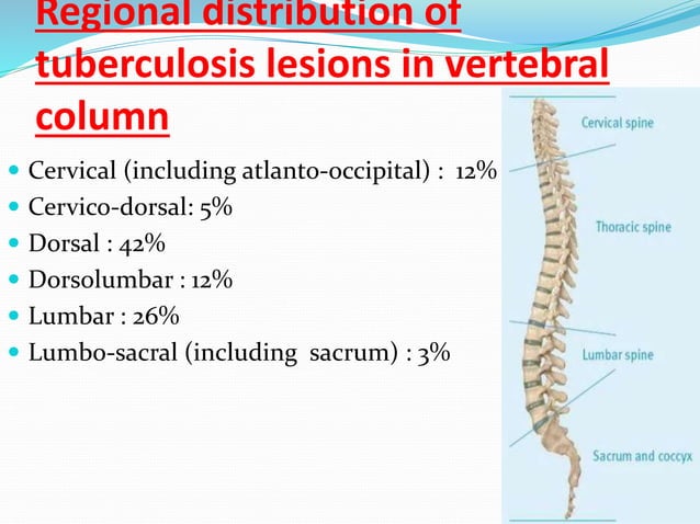 Tuberculosis of spine (pott’s spine) | PPTX | Physical Therapy | Wellness