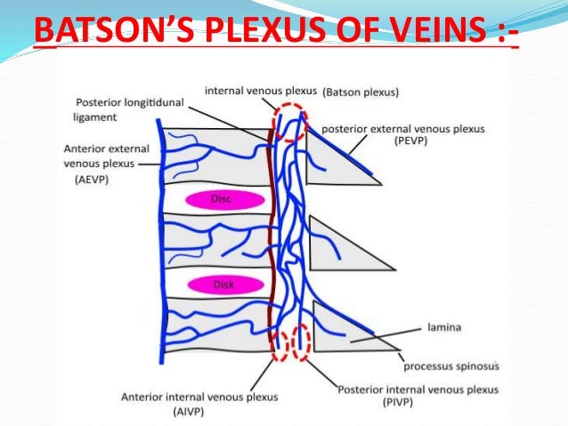Tuberculosis of spine (pott’s spine)
