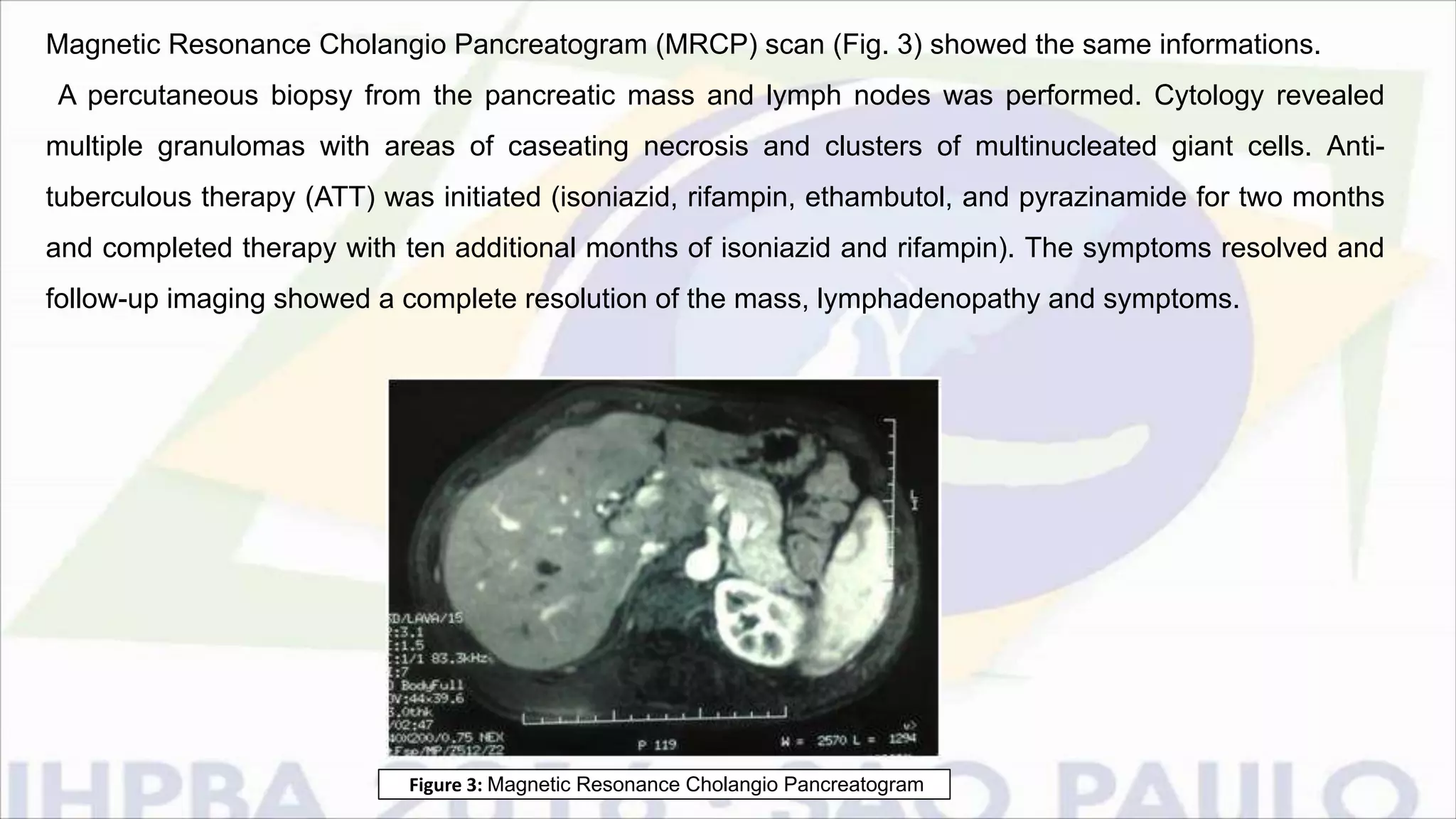 Tuberculosis of the Pancreas Diagnostic Challenges.ppt