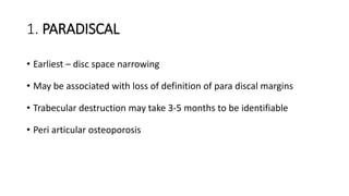 TUBERCULOSIS OF THE SPINE AND MANAGEMENT | PPT