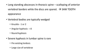 TUBERCULOSIS OF THE SPINE AND MANAGEMENT | PPTX