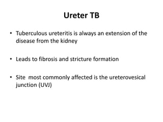 tuberculosis_of_urinary_tract.ppt