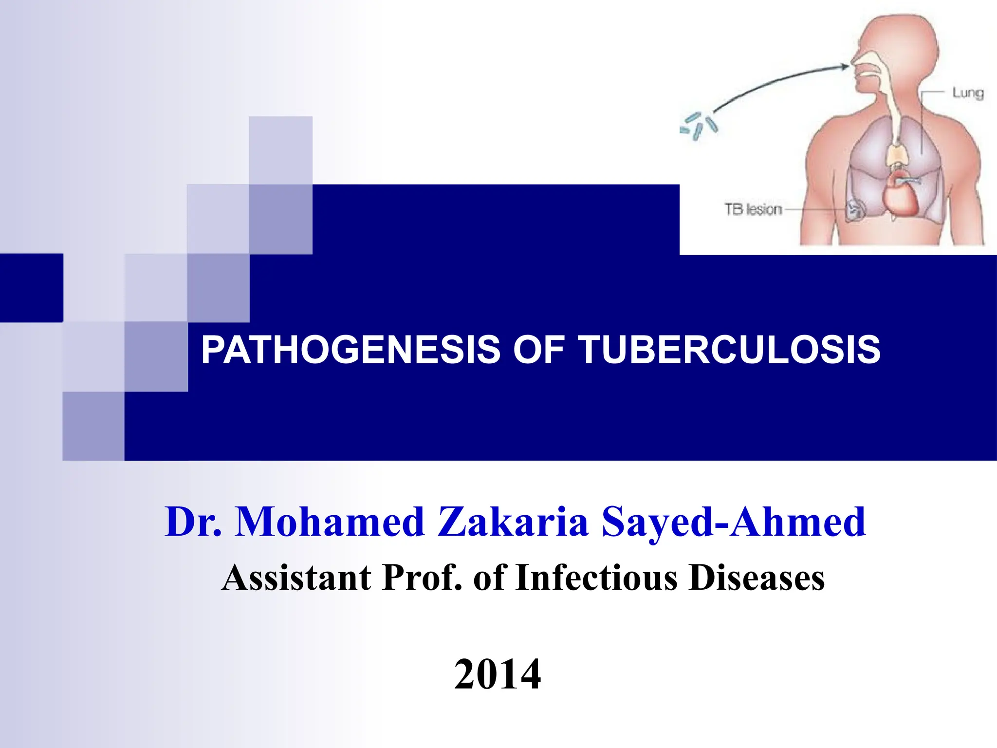 medial power point tuberculosis pathology 1.pptx